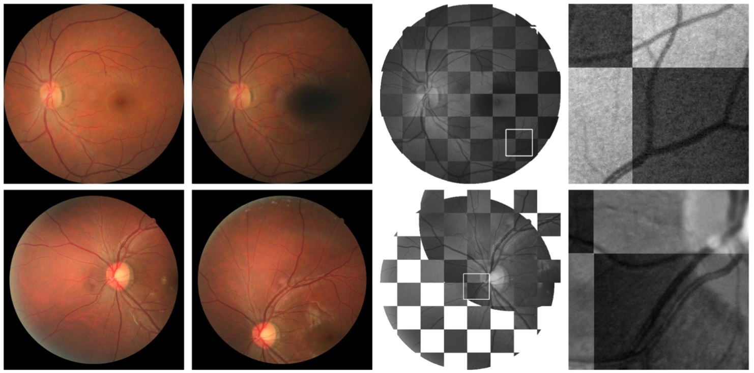 Retinal image registration under the assumption of a spherical eye ...